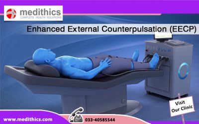 Enhanced External Counterpulsation (EECP)- A brief discussion about it